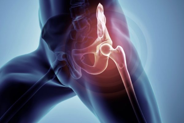 Perth Sports Physio | Expert Sports Physio in Nedlands